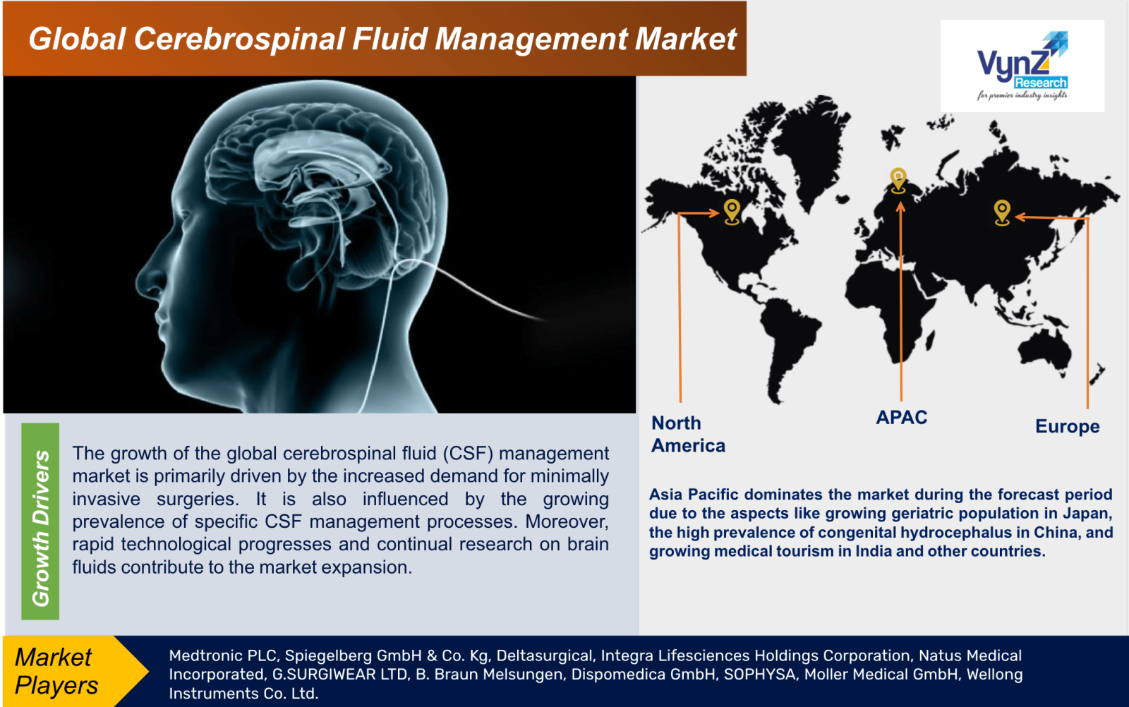 Cerebrospinal Fluid Management Market Size & Share | 2030